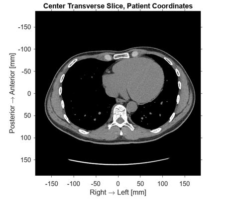 Read Process And Write 3 D Medical Images