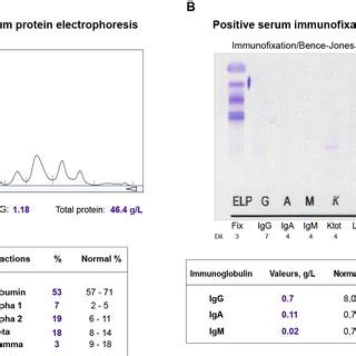 Some Of The Laboratory Findings Seen In Our Patient With Multiple Download Scientific Diagram