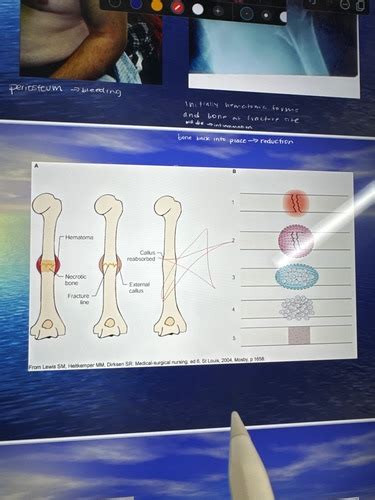 Musculoskeletal System Flashcards Quizlet