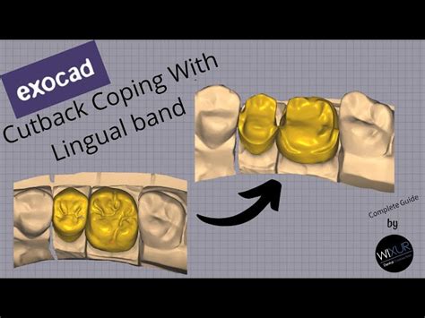 Exocad Quick Guide Using The Cutback Library Quotthimble Eeschema