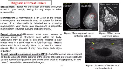 Diagnosis Technique Of Different Types Cancer Ppt