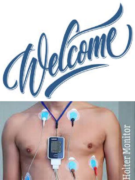 Holter Monitoring Pdf Medicine Cardiovascular Physiology
