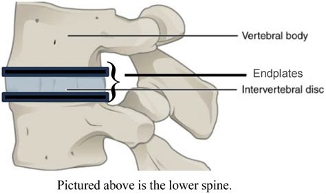 Basivertebral Nerve Ablation Dr David Provenzano