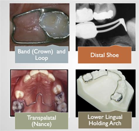 Space Management Flashcards Quizlet