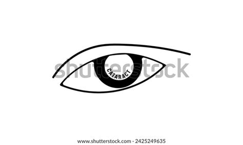 Cataract Symbol Black Isolated Silhouette Stock Vector Royalty Free