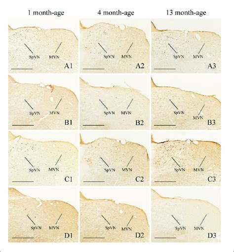 Representative Photomicrographs Showing Fos Immunolabeling In The MVN