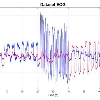 Graphical Representation Of EOG Data Set With Both Vertical And Download Scientific Diagram