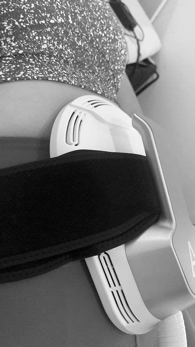 Separation Of Rectus Abdominis Discover Sculpt