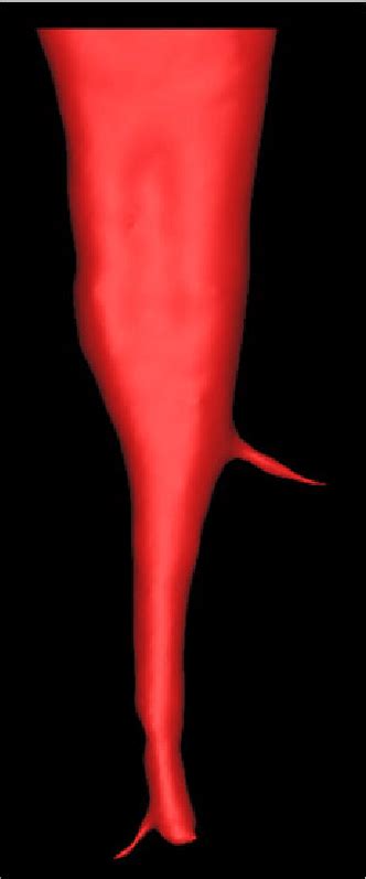 Accessory Canals Located In The Apical And Middle Third Of The Root