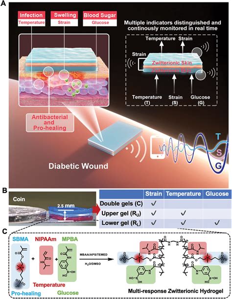 A Scheme Illustration Of The Sandwich‐structured Sensor Based On Download Scientific Diagram