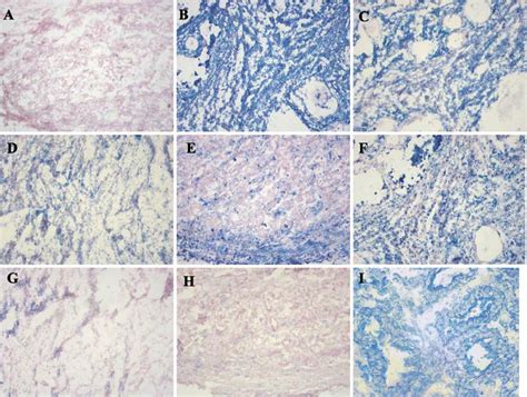 Immunohistological Analysis Of Leukocyte Sub Populations Infiltrating