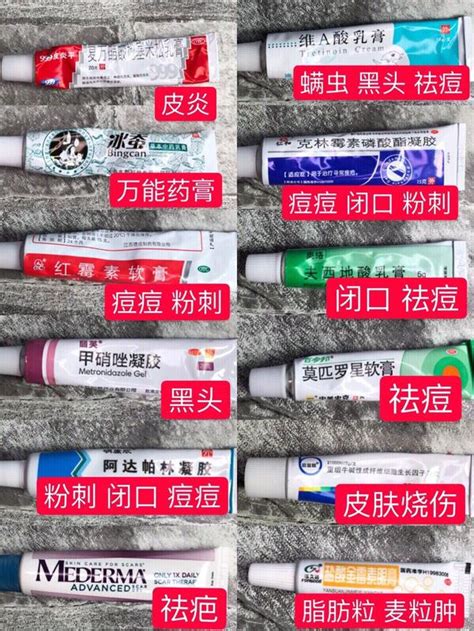 毛囊炎患者乱用药的危害光靠抗生素和外模药膏根治不了 知乎