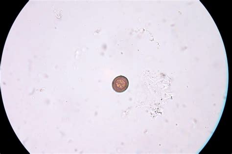 Premium Photo Understanding Preventing And Treating Trichinellosis