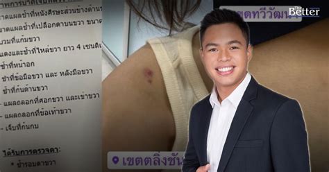 ส ส ก้าวไกล โพสต์ขอโทษใช้ความรุนแรงทำร้ายแฟนสาว The Better News