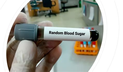 Blood Sugar Randon Test Price In Puruliya Find Diabetes Test Labs