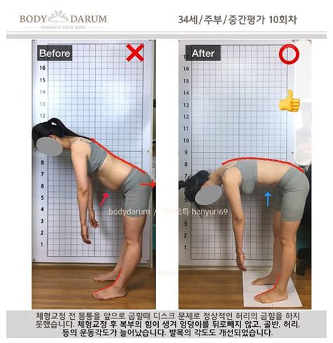 영통필라테스체형교정 바디다룸 허리디스크골반틀어짐 Beforeandafter 네이버 블로그
