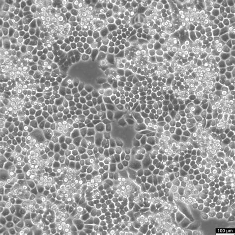 A2780 Cells