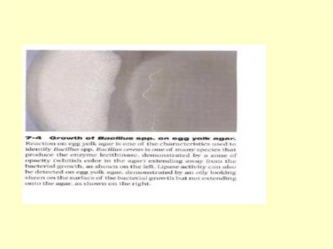 1 Spore Forming Gram Positive Bacilli 2014 Ppt
