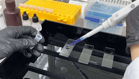 Histopathology Staining Explained Hande And Ihc Staining