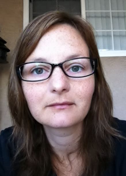 My Adventures On Prednisone Rosey Cheeks