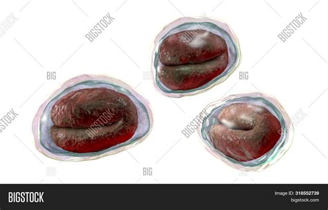 Eggs Helminths Image And Photo Free Trial Bigstock