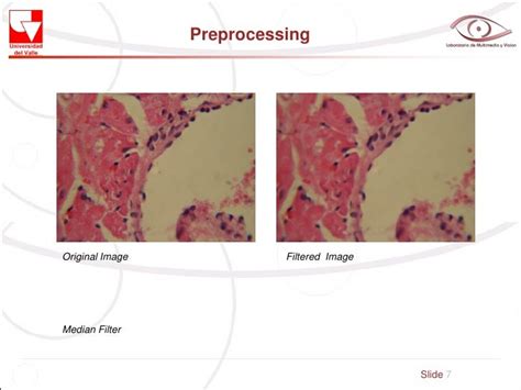 A Cells Segmentation Approach In Epithelial Tissue Using Histology Im