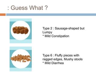 Constipation In Elderly Pptx