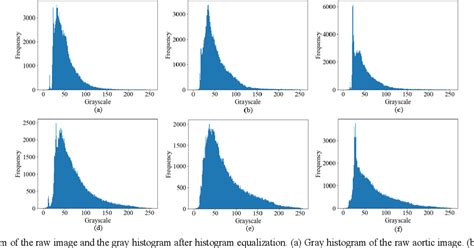 Figure 4 From Hybrid Deep Learning Model For Arch Of Aorta