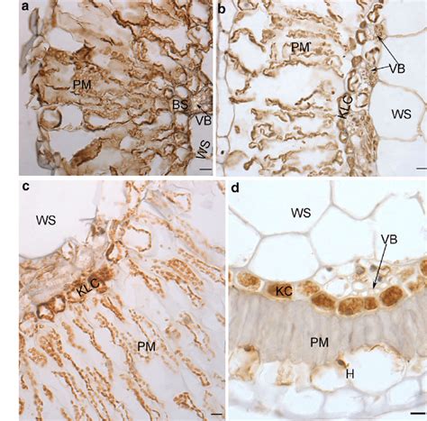 Light Micrographs Illustrating In Situ Immunolocalization Of Rubisco In