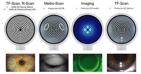 Diagnóstico CoverOptometria