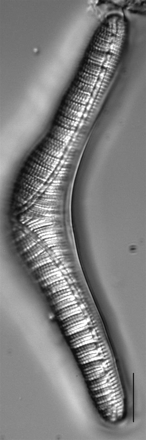 Epithemia Smithii Species Diatoms Of North America
