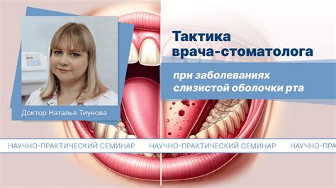 Тактика врача-стоматолога при заболеваниях слизистой оболочки рта