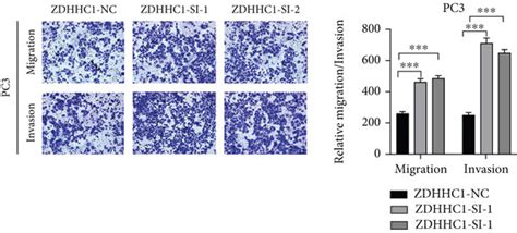 Downregulated Zdhhc1 Promotes Cell Proliferation Migration And