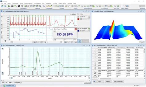 Labchart Analysis Modules Powerful Data Interpretation Made Simple
