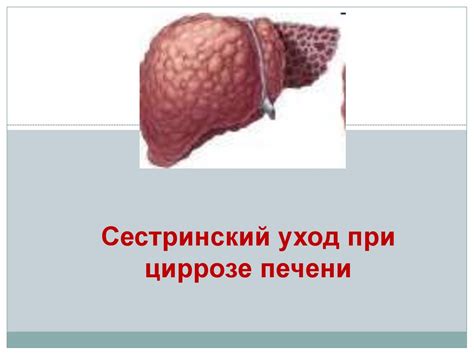 Сестринский уход при хроническом гепатите презентация онлайн