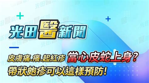 光田醫新聞 當心皮蛇上身！帶狀皰疹這樣預防！ Youtube