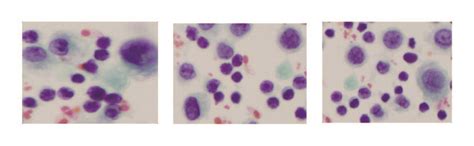 visual results of segmenting cell nuclei from cpe images a original