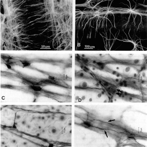 A B Show The Same Area Of Retina A Showing The Astrocytes Visualised Download Scientific