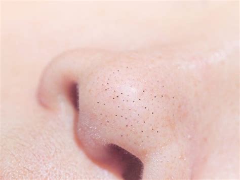 How To Shrink Pores On Nose Get Rid Clean Open Black Pores In Nose American Celiac