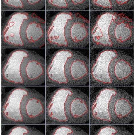 PDF An Active Contour Model Based On Local Fitted Images For Image Segmentation