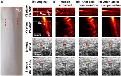 Biosensors Free Full Text Motion Compensation For D Multispectral