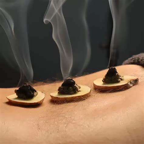 Moxibustion