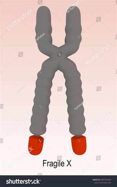 3d Illustration Chromosome Fragile X Script Stock Illustration 2007335393 Shutterstock