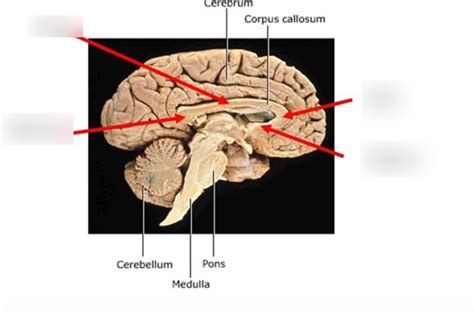 Diagram Of Corpus Callosum Quizlet