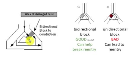 Anti Arrhythmia Drugs Flashcards Quizlet