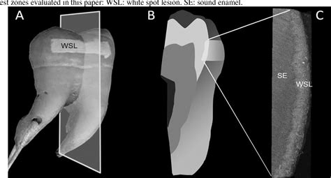 Figure 1 From Confocal Laser Scanning Reflection Microscopy Applied To