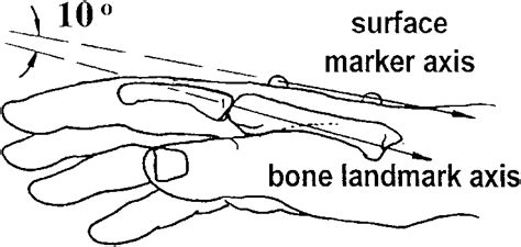 Schematic Two Dimensional View Of Misalignment Download Scientific