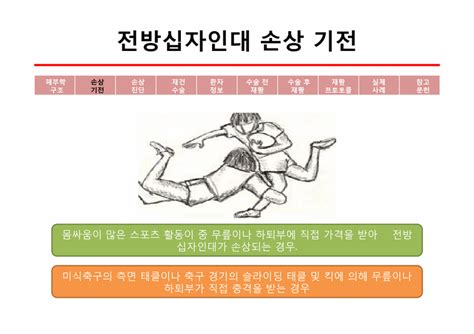 의학 전방십자인대 재건 수술 환자의 재활운동 레포트 의약계열