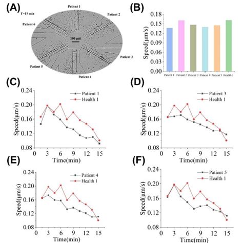 Chemotaxis Of The Healthy Neutrophils 15 Mm D Glucose And 5 Mm