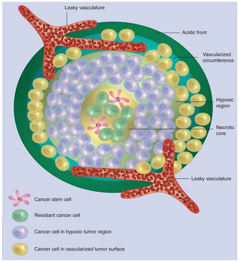 The Schematic Drawing Shows Solid Tumor Organization With The Download Scientific Diagram